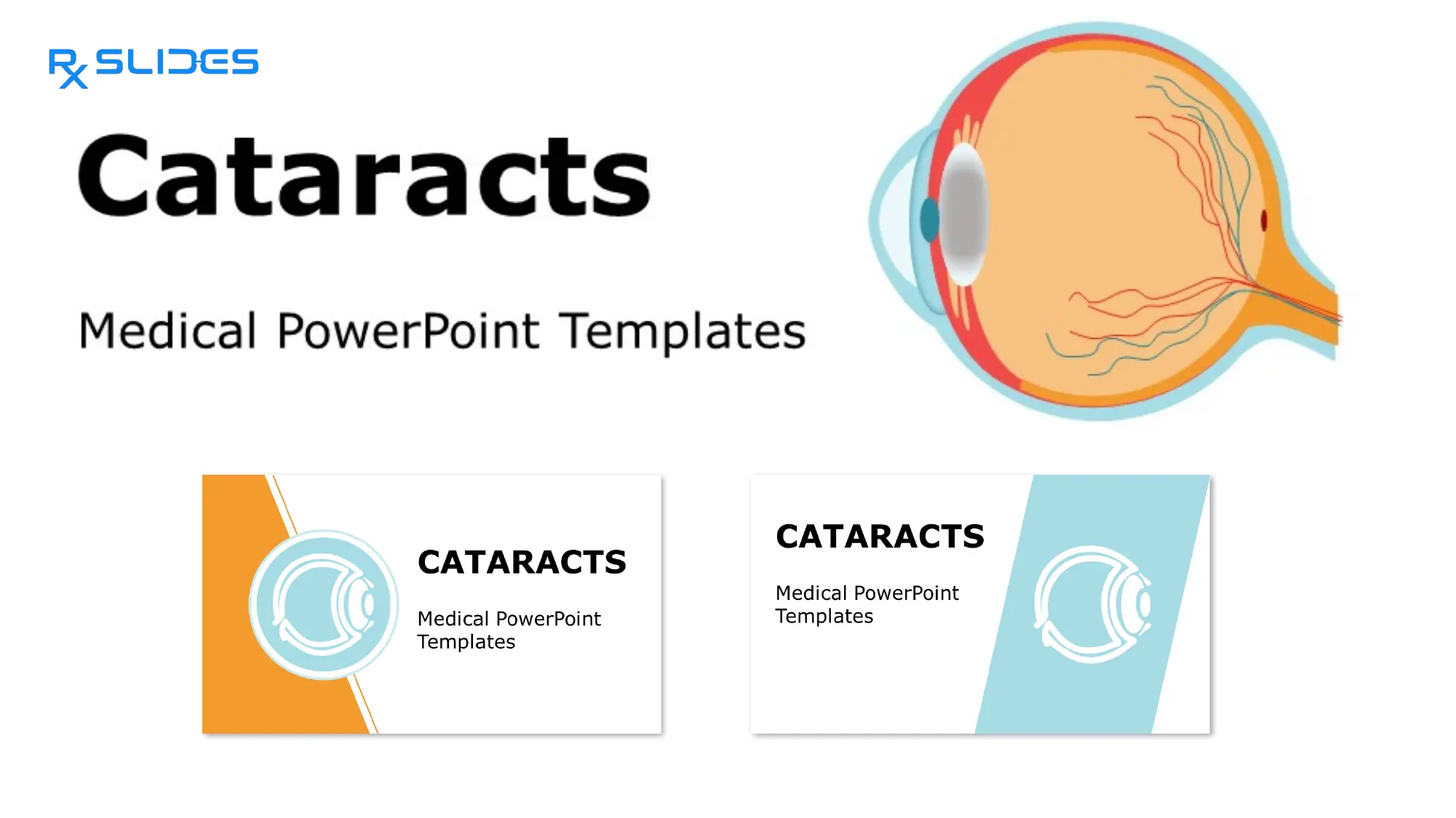 Download Cataracts PowerPoint Template|