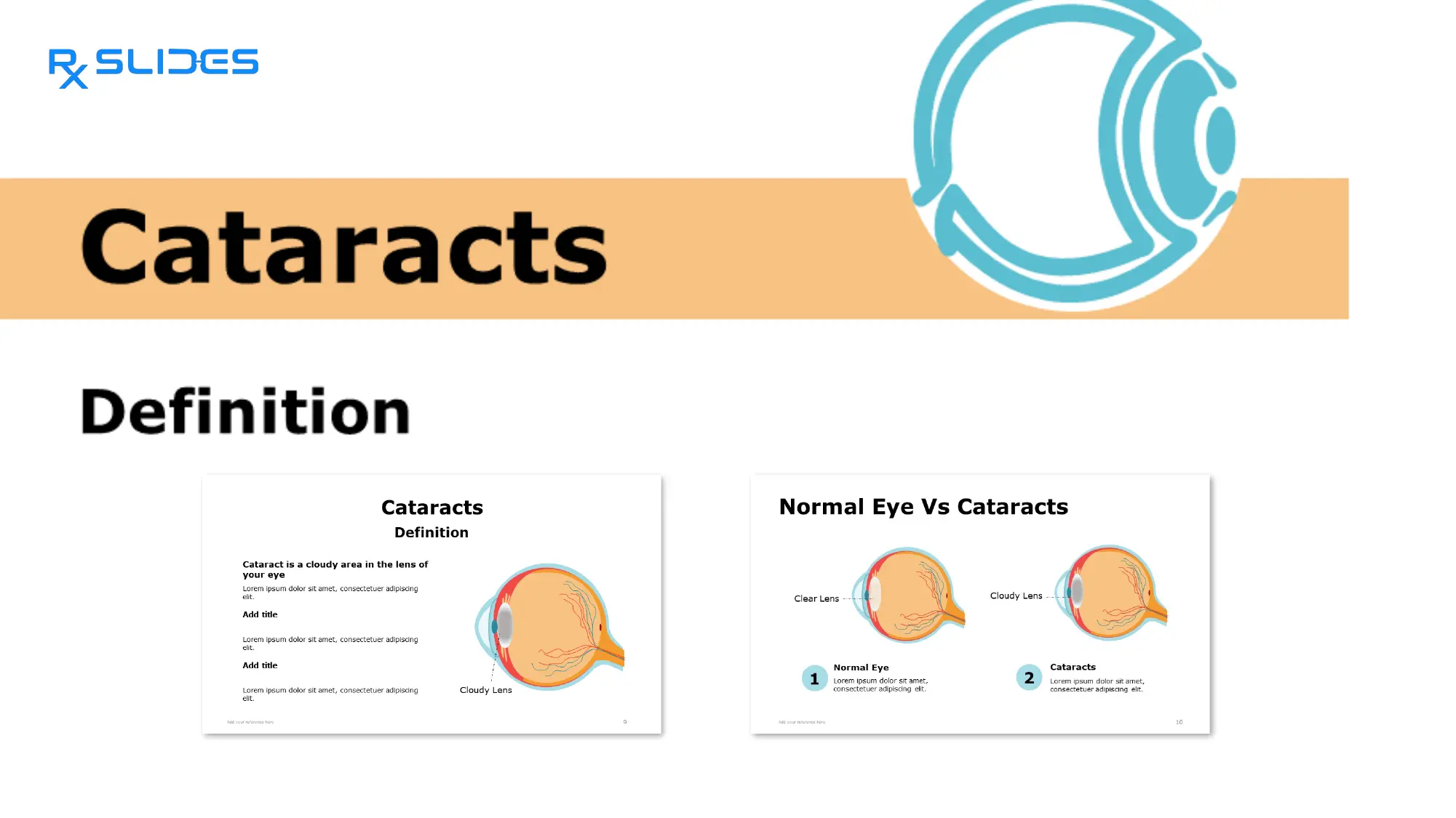 Download Cataracts PowerPoint Template|