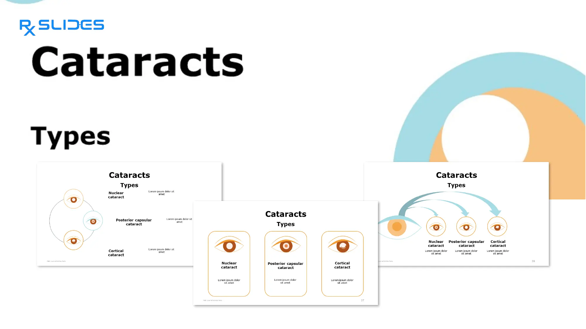 Download Cataracts PowerPoint Template|
