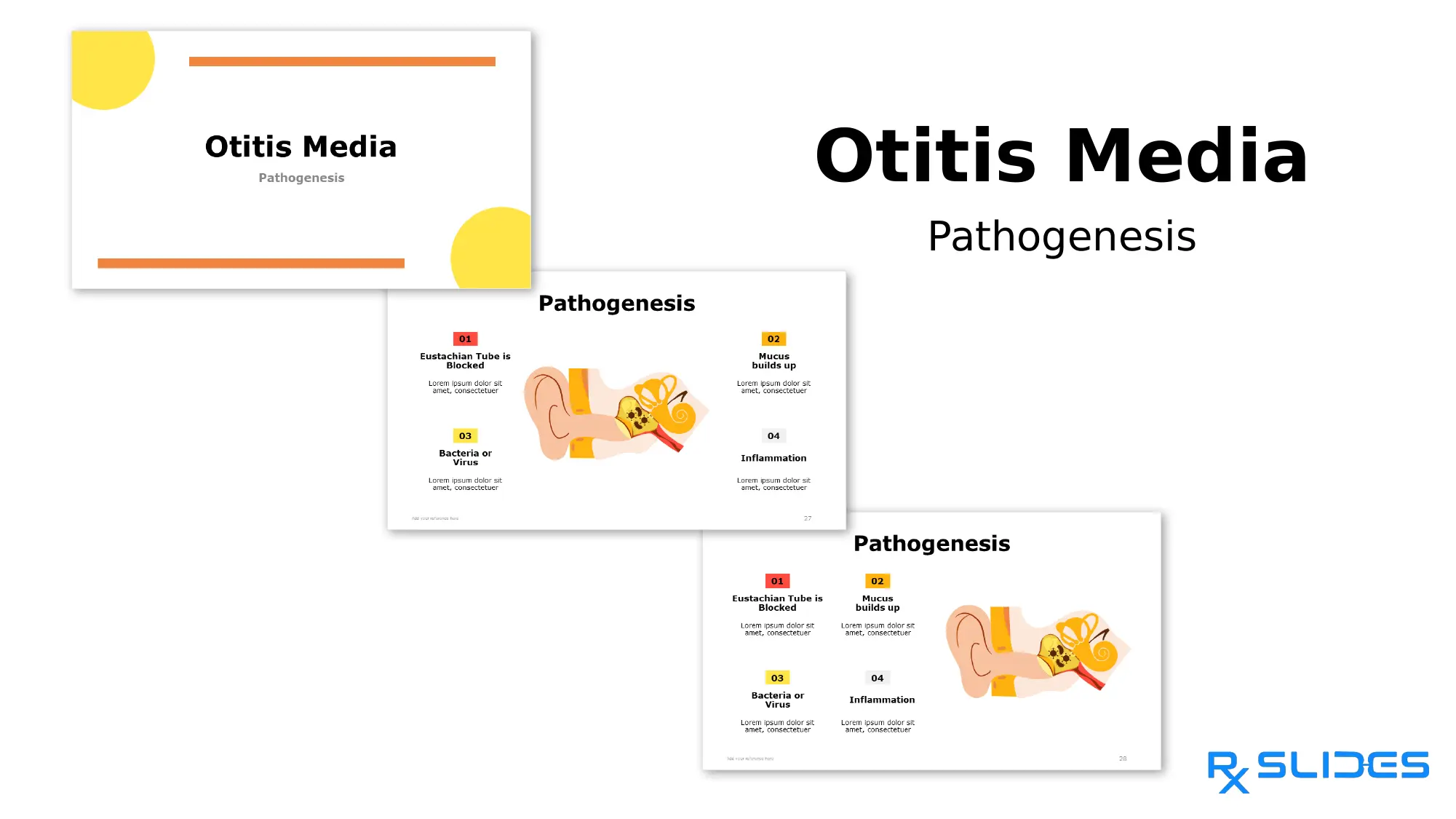 Download Otitis Media PowerPoint Template| RxSlides