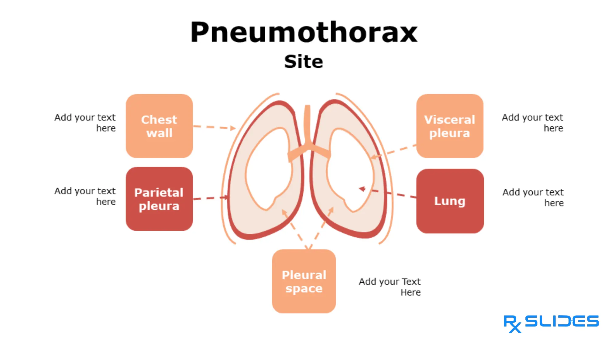 Download Pneumothorax PowerPoint Template| RxSlides