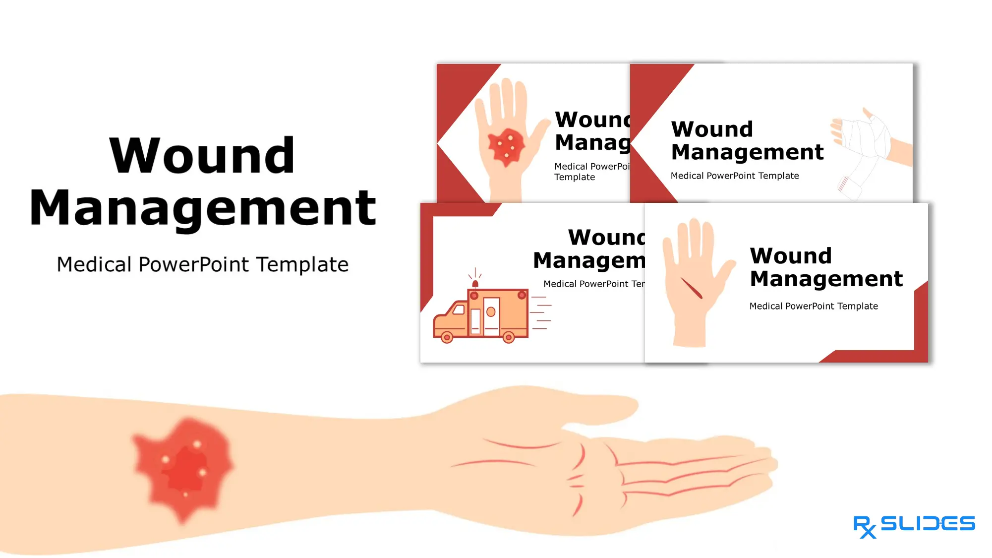 Download Wound Management PowerPoint Template| RxSlides