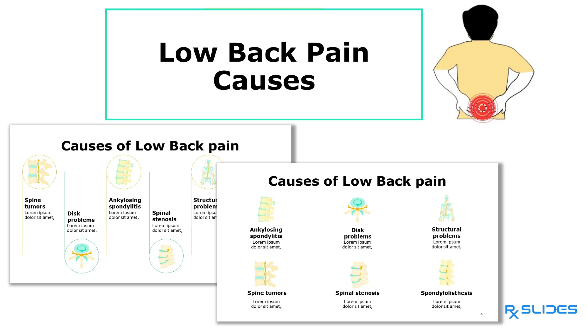 Download Low Back Pain PowerPoint Template|RxSlides