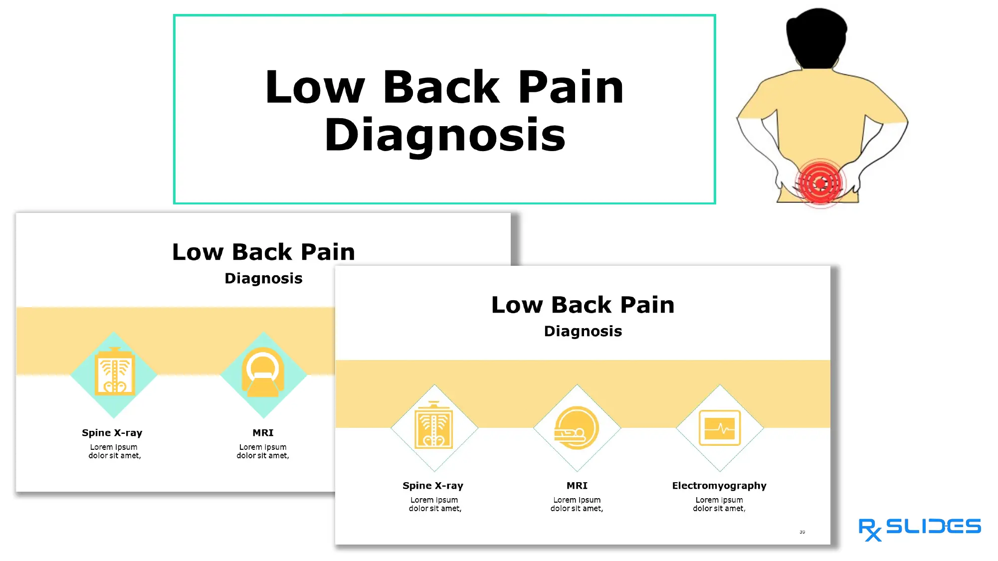 Download Low Back Pain PowerPoint Template|RxSlides