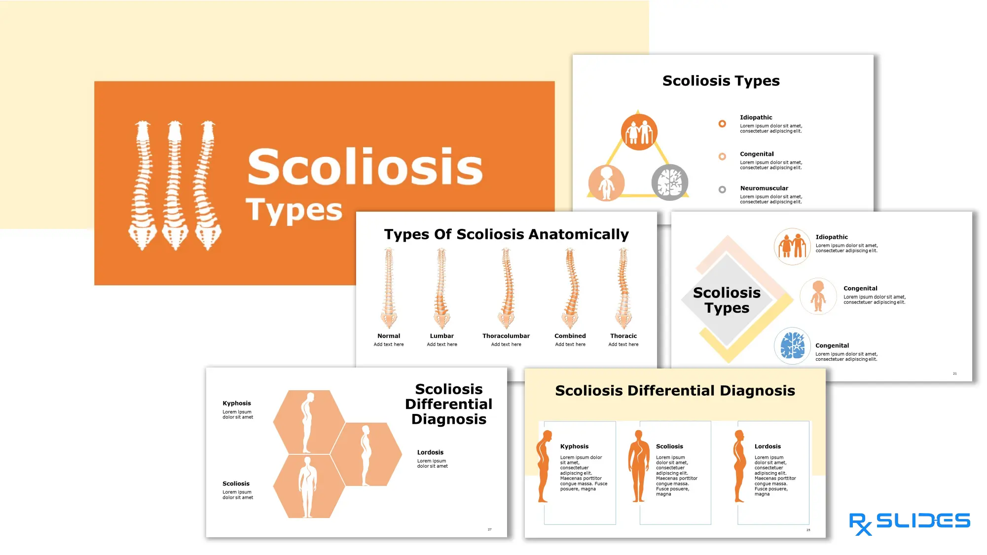 Download Scoliosis PowerPoint Template| RxSlides