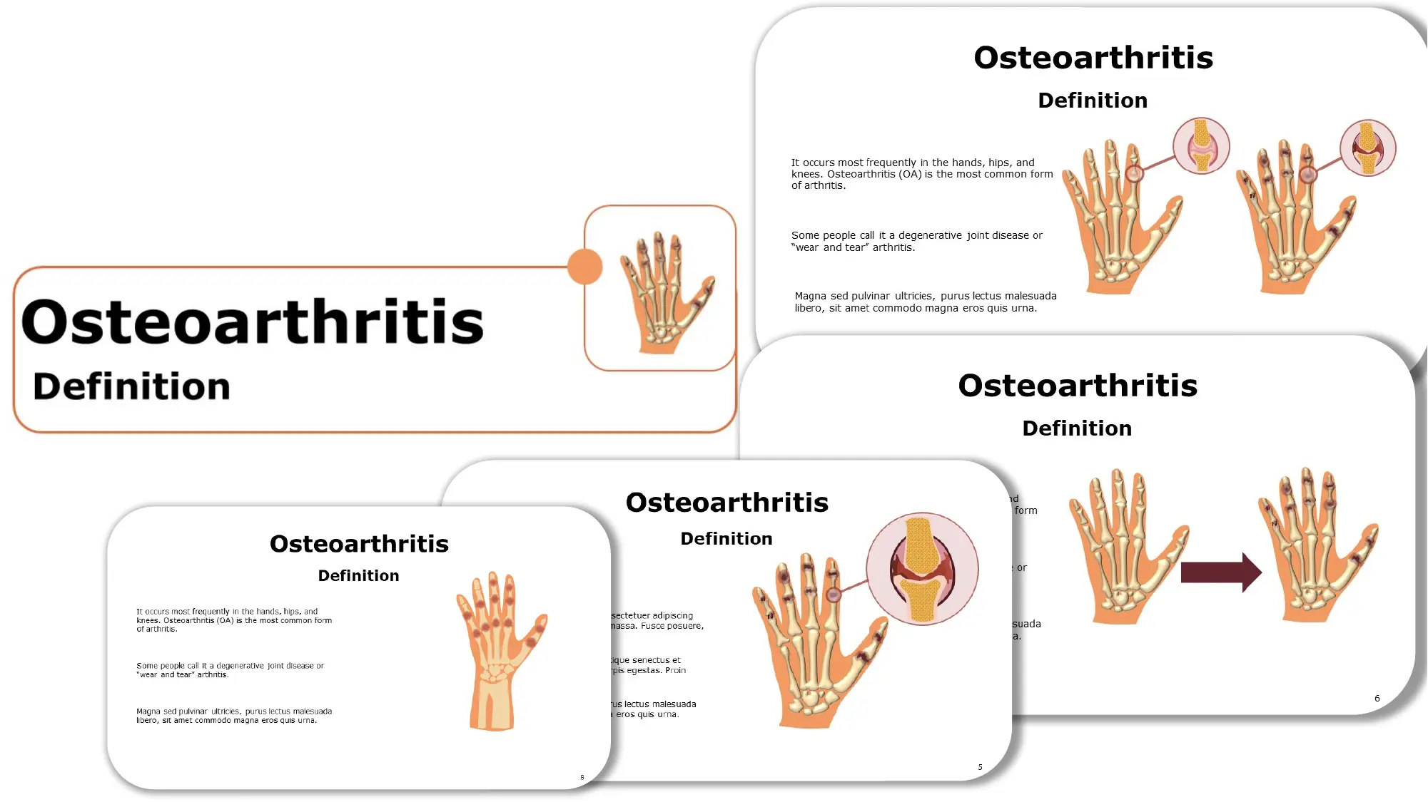 Download Osteoarthritis PowerPoint Template|RxSlides