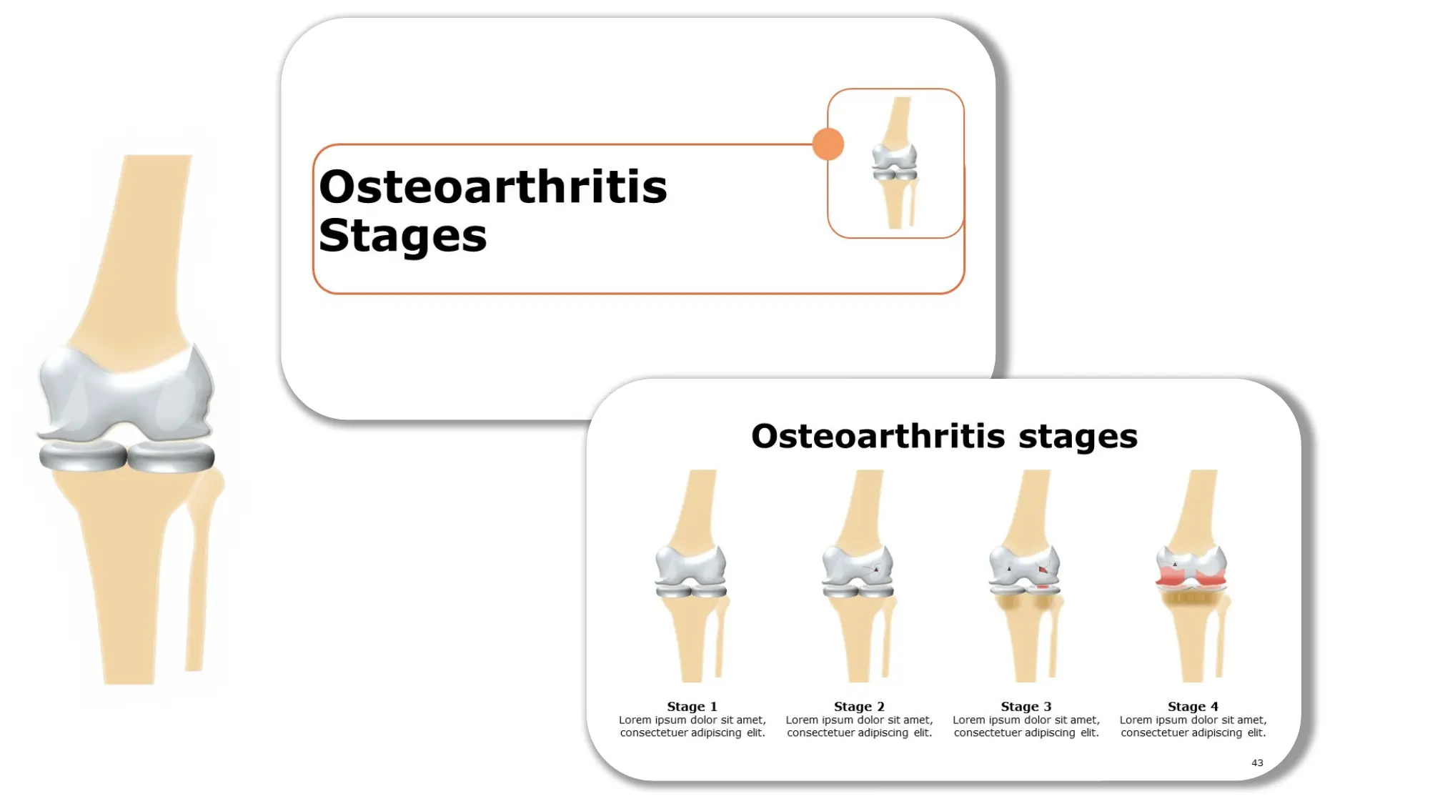 Download Osteoarthritis PowerPoint Template|RxSlides