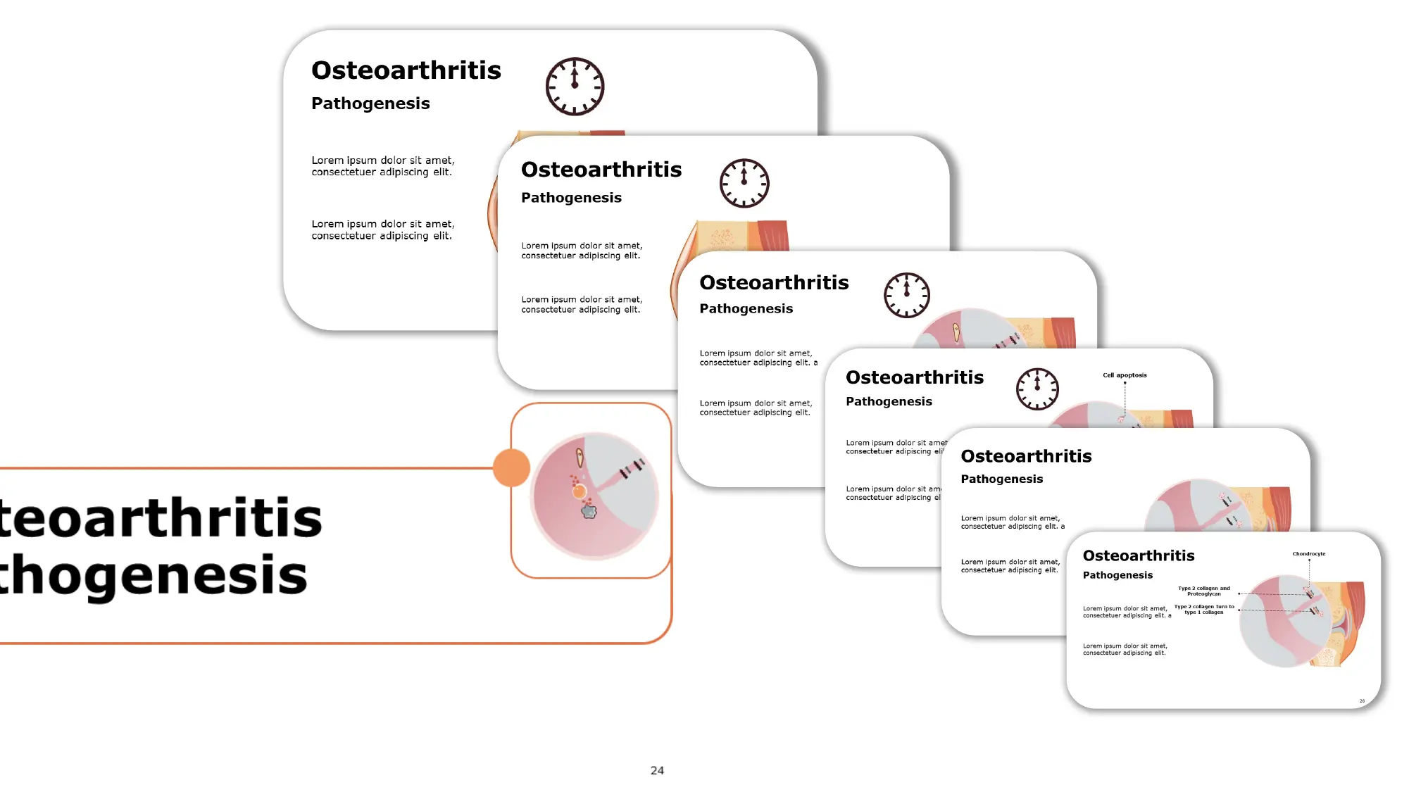 Download Osteoarthritis PowerPoint Template|RxSlides