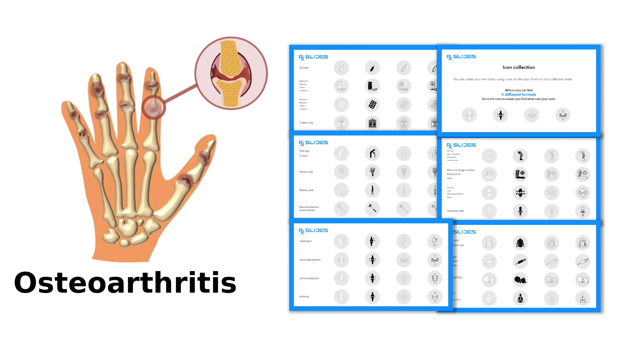 Download Osteoarthritis PowerPoint Template|RxSlides
