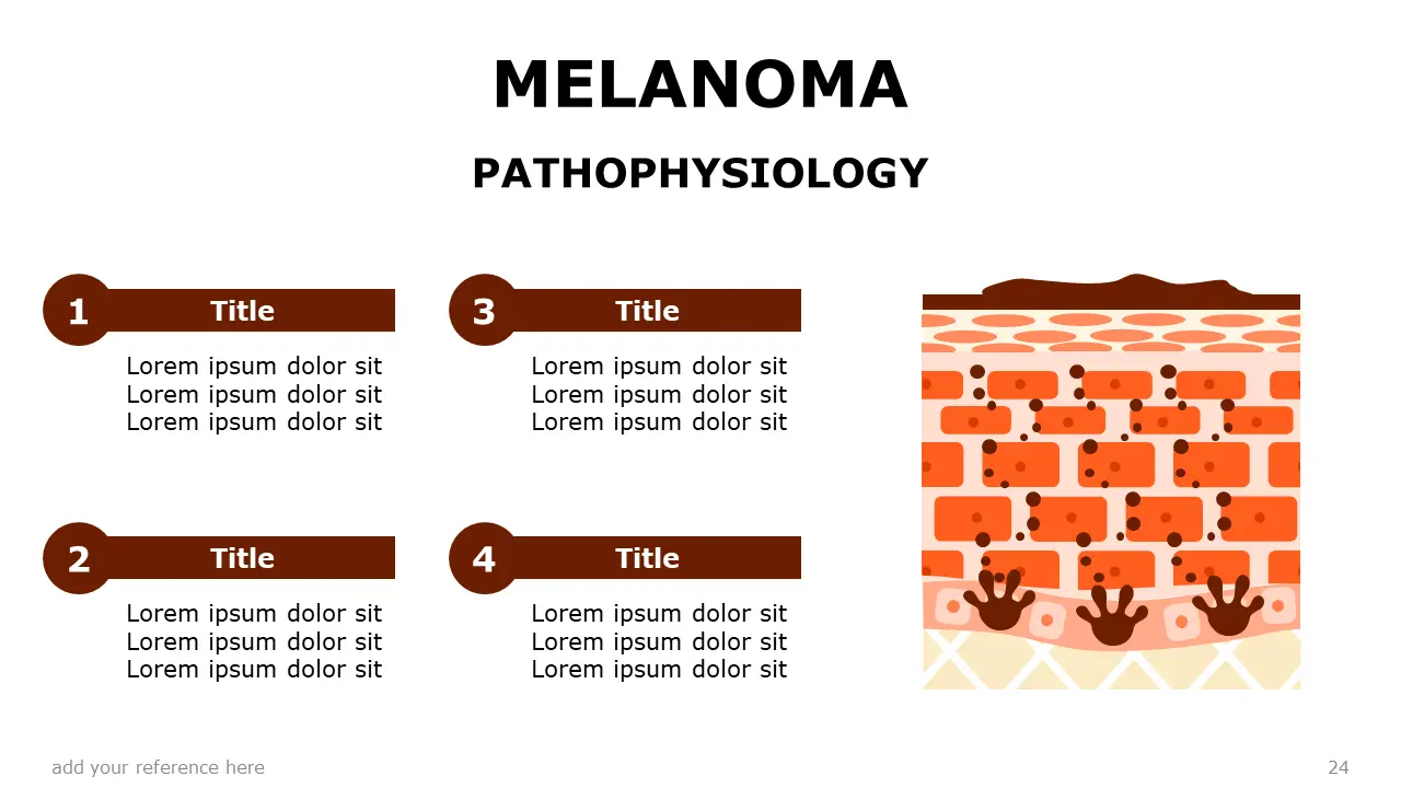 Download Melanoma PowerPoint Template|RxSlides