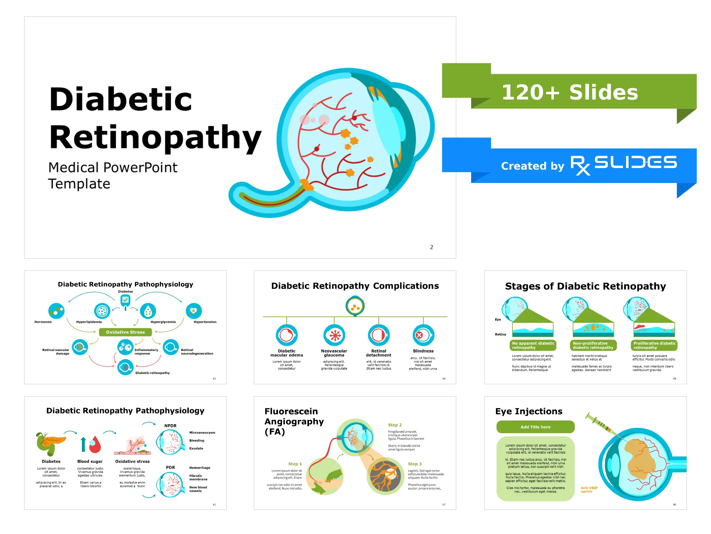 Download Diabetic Retinopathy PowerPoint Template| RxSlides