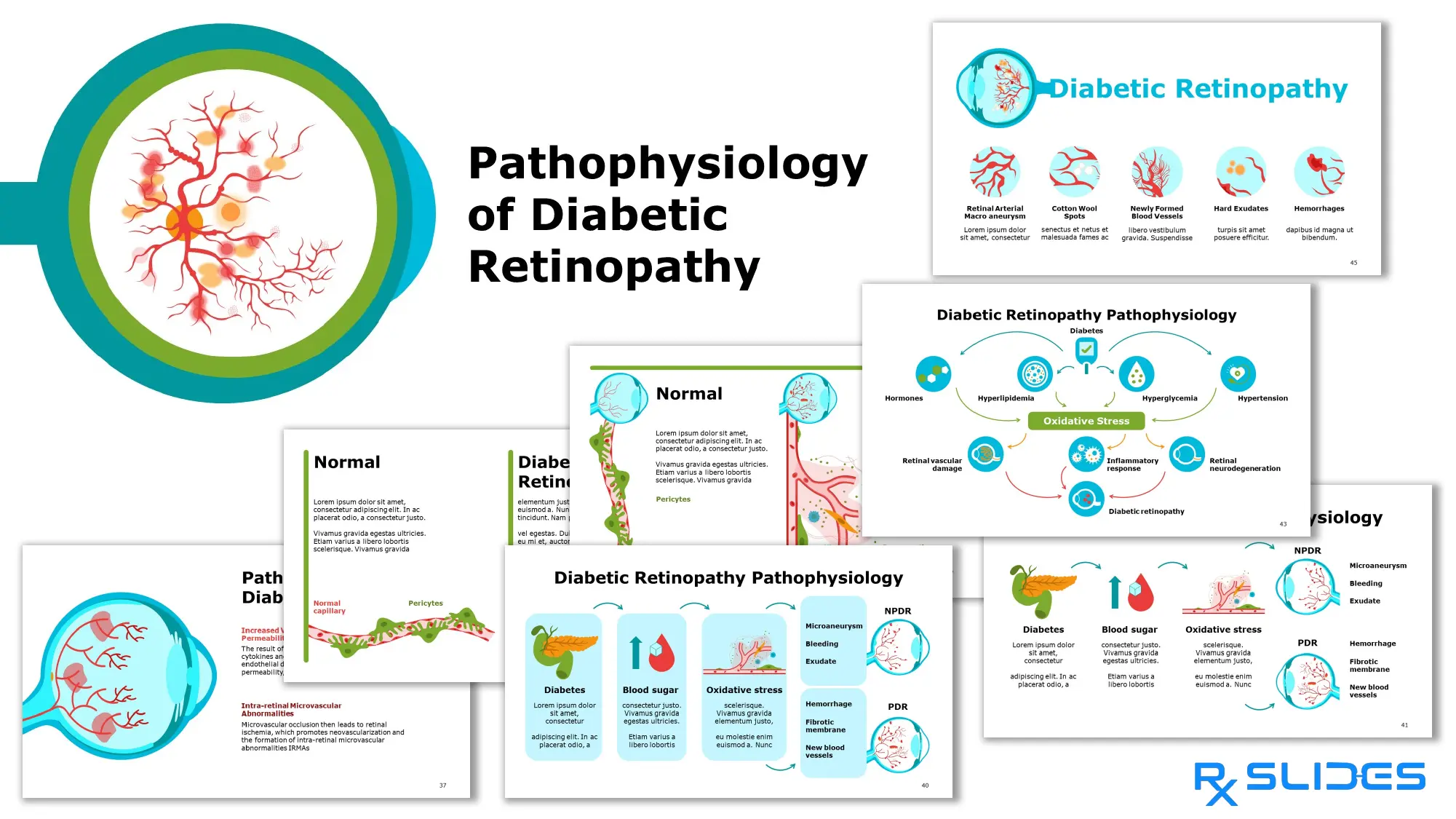 Download Diabetic Retinopathy PowerPoint Template| RxSlides