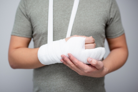 8 Common Signs and Symptoms of Broken Bones
