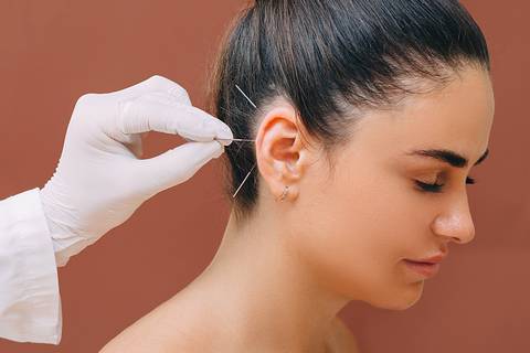 8 Different Types of Acupuncture and How They Work