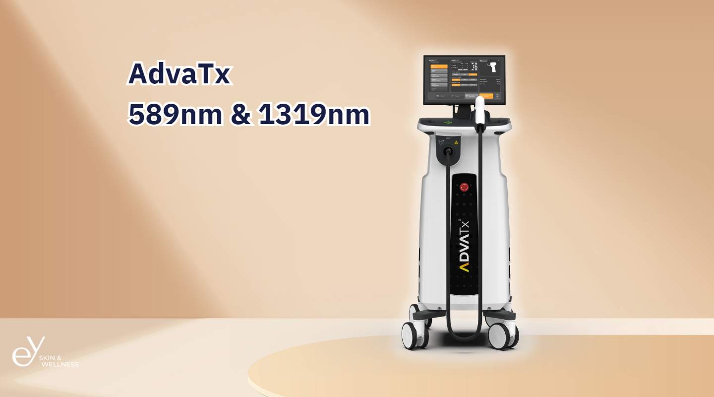 AdvaTx vs. Dual Yellow vs. Vbeam สำหรับการรักษาสิว