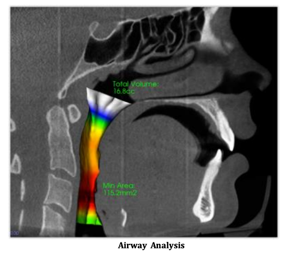 Tips for Choosing a CBCT Reporting Partner | BeamReaders