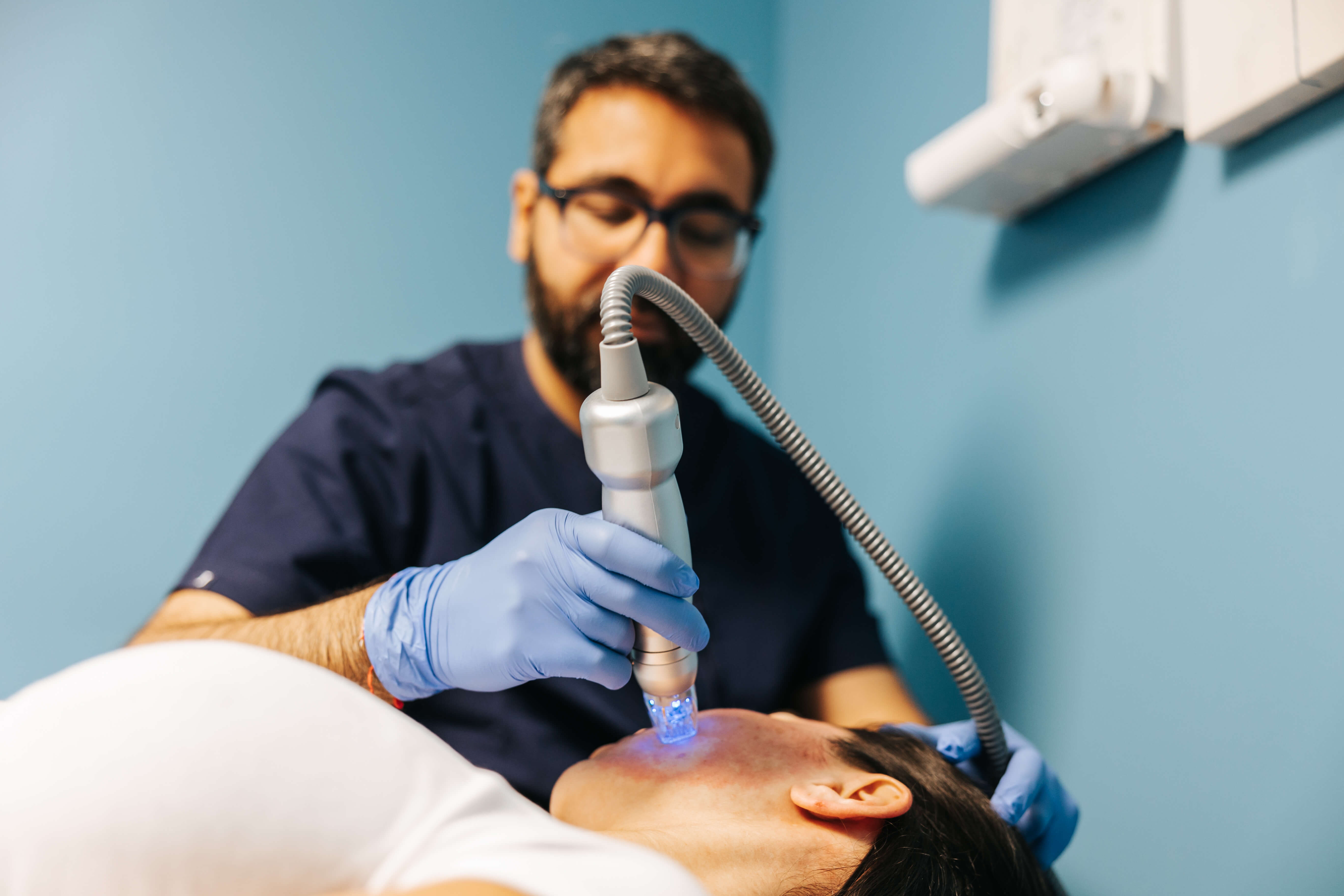 Scarlet RF Microneedling - 5 Things to Know Before Treatment