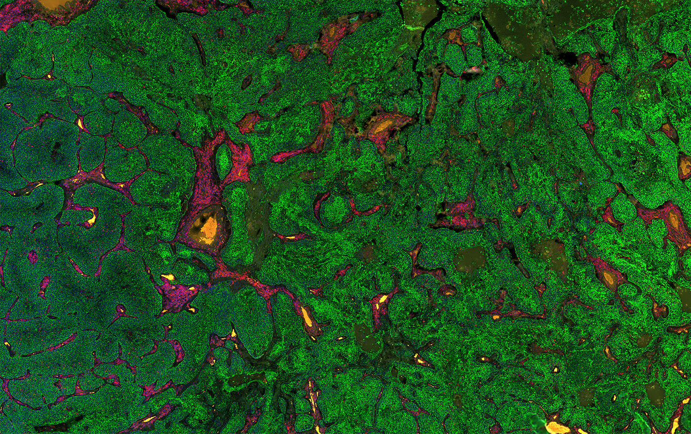 Spatial omics: between technology development and early discoveries