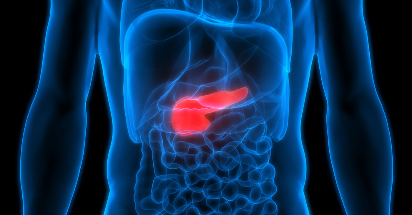 First AI tool for predicting pancreatic cancer subtypes from AP-HP and ...