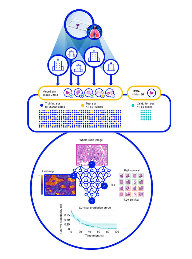 Case study: MesoNet⎢Owkin blog