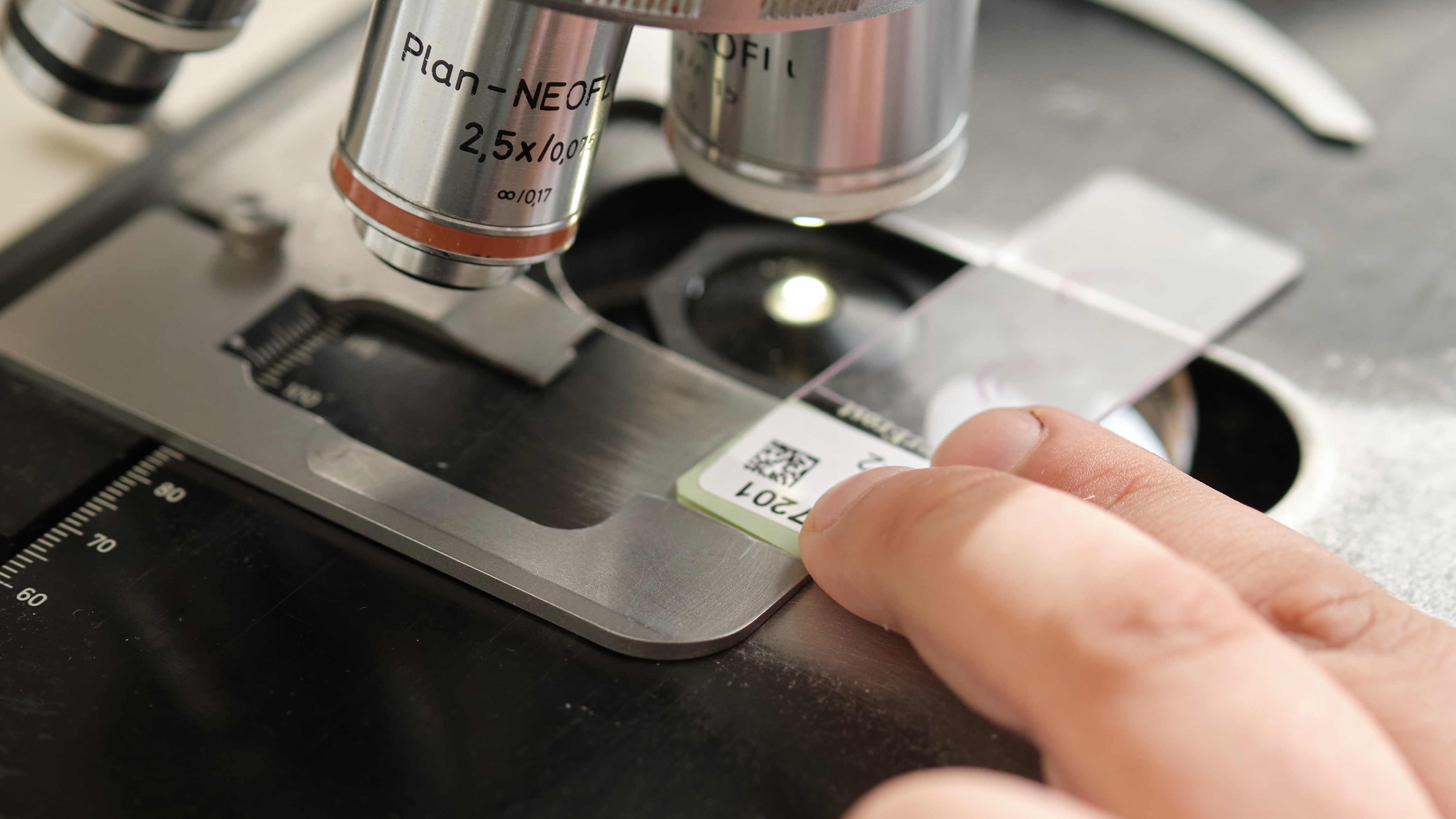 Owkin and Cerba Path collaborate to use AI to improve breast and ...