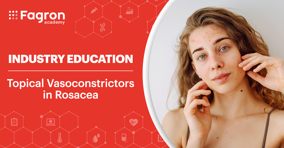 Vasoconstrictors for the Topical Management of Rosacea | Fagron Academy