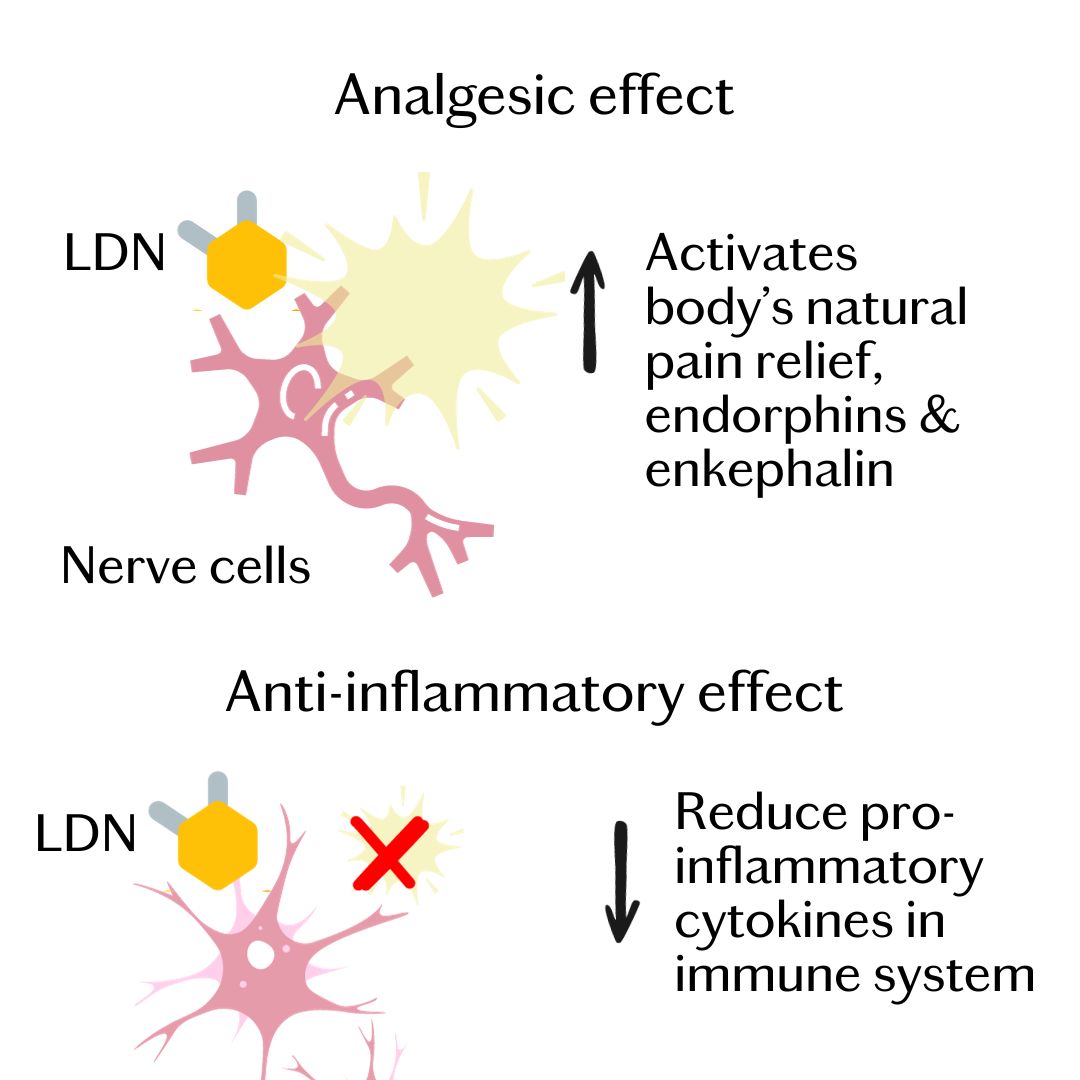 Low Dose Naltrexone for Fibromyalgia | MoreGoodDays Pain-management Program