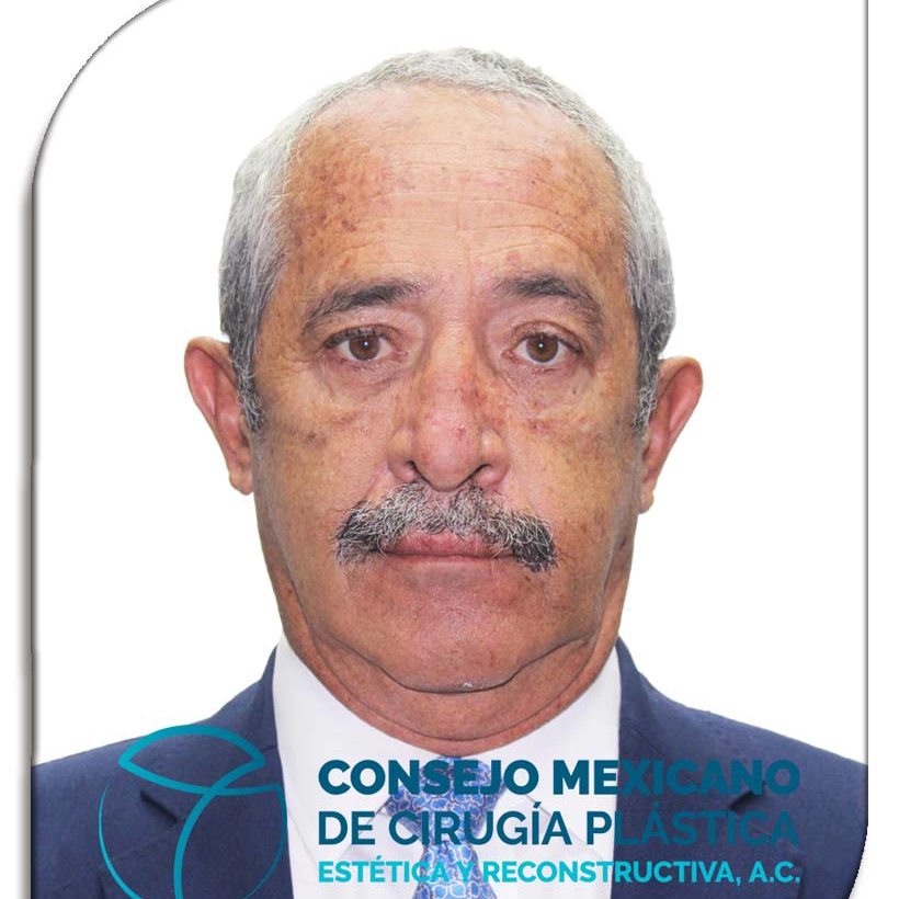Rinoplastia | Dr. Luis Alfonso Ortiz Oscoy