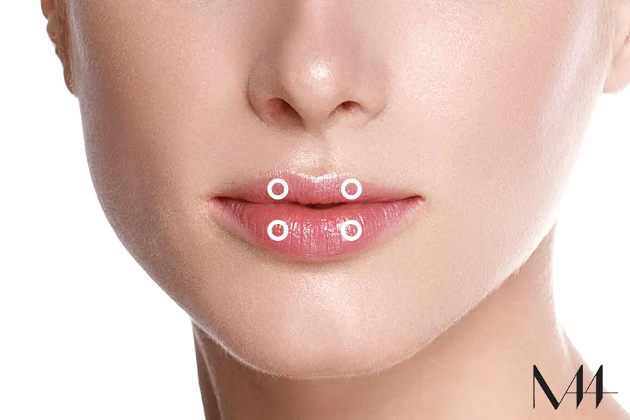 Nonsurgical Aesthetic Treatments for the Face - Med 44 Arcadia Phoenix