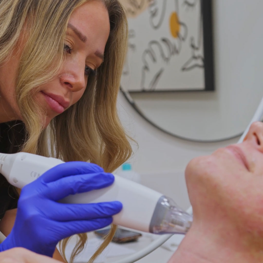 Esthetics Center | Alpha Aesthetics Partner 001 | El Dorado Hills, CA