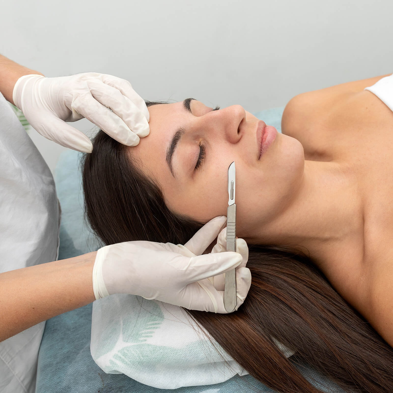Dermaplaning