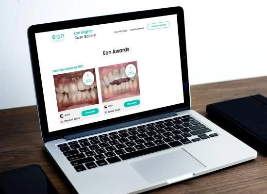 Eon Aligner Case Gallery: Key Benefits & Case Studies Using Aligners