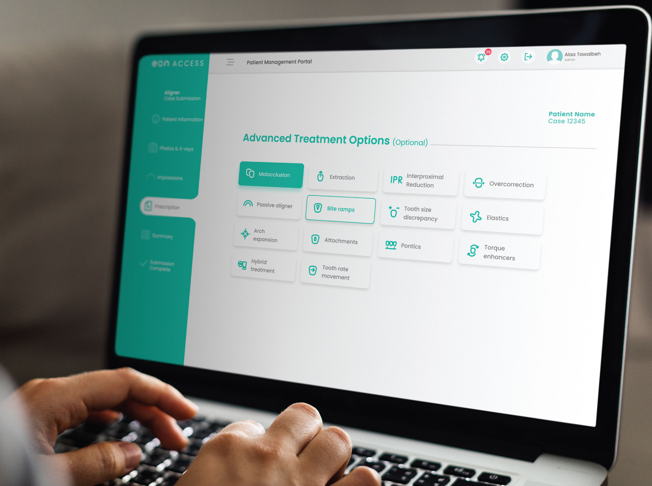 Clear Aligner Treatment Planning: A Guide to Dental Success