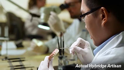 What Is HYBRIDGE® ? | Full Arch Dental Implants Bridge