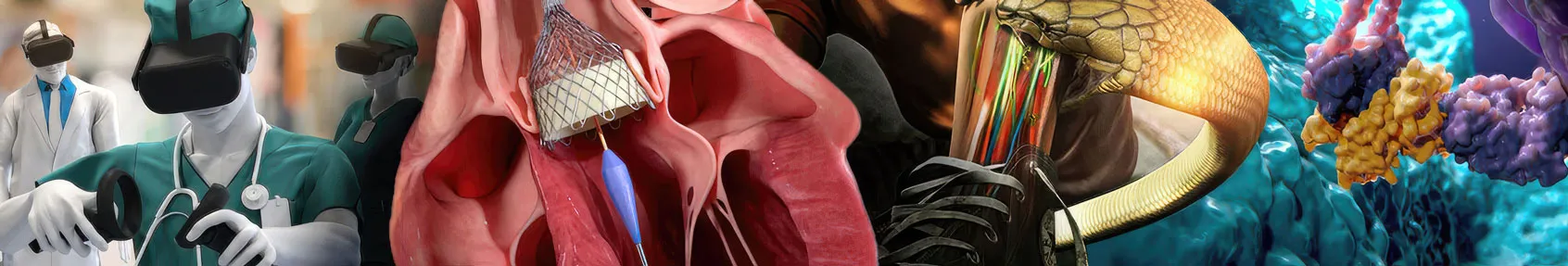 activL Artificial Disc - Relief from Degenerative Disc Disease | Image