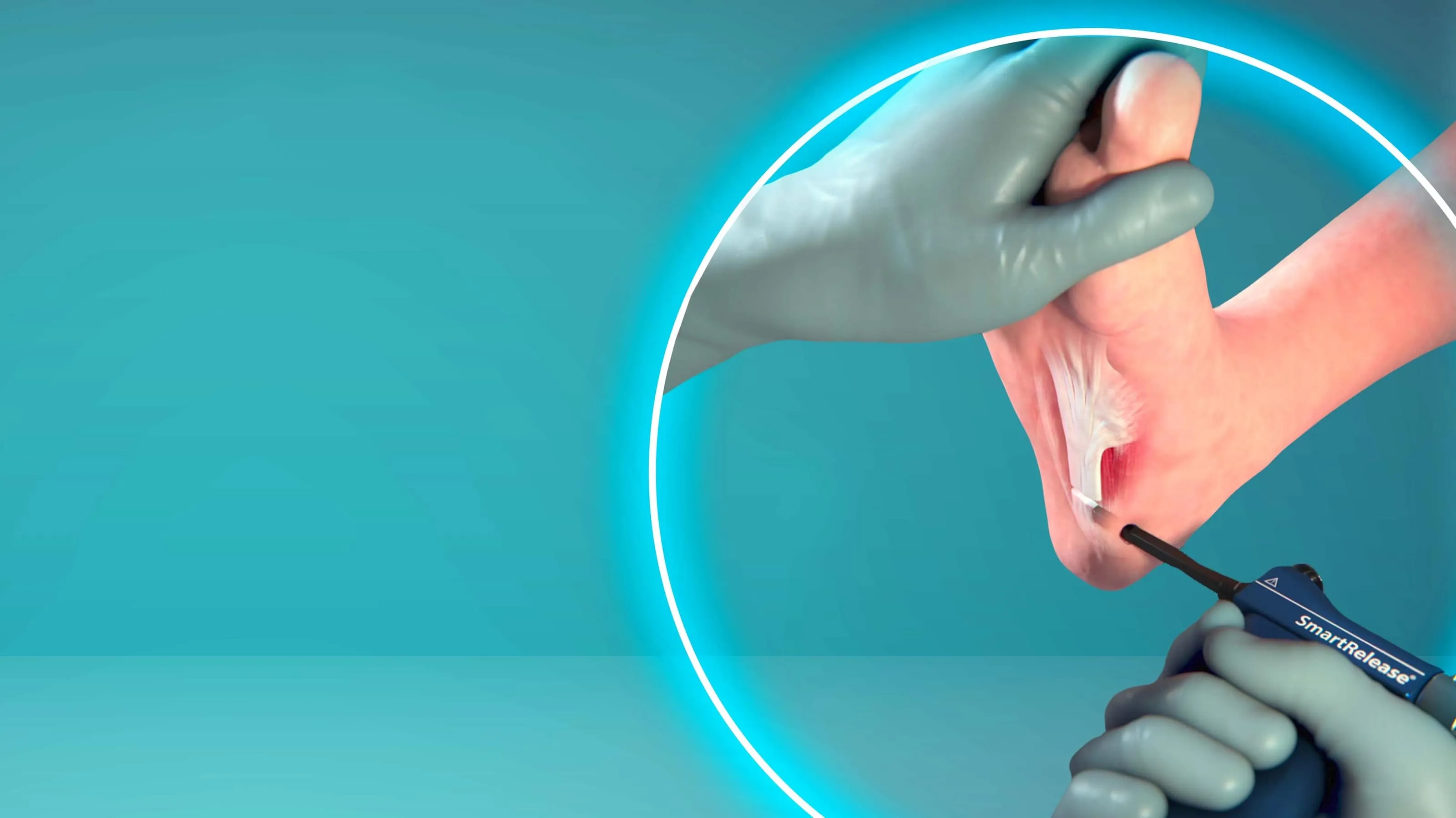 VR Surgery Simulator | Ghost Medical