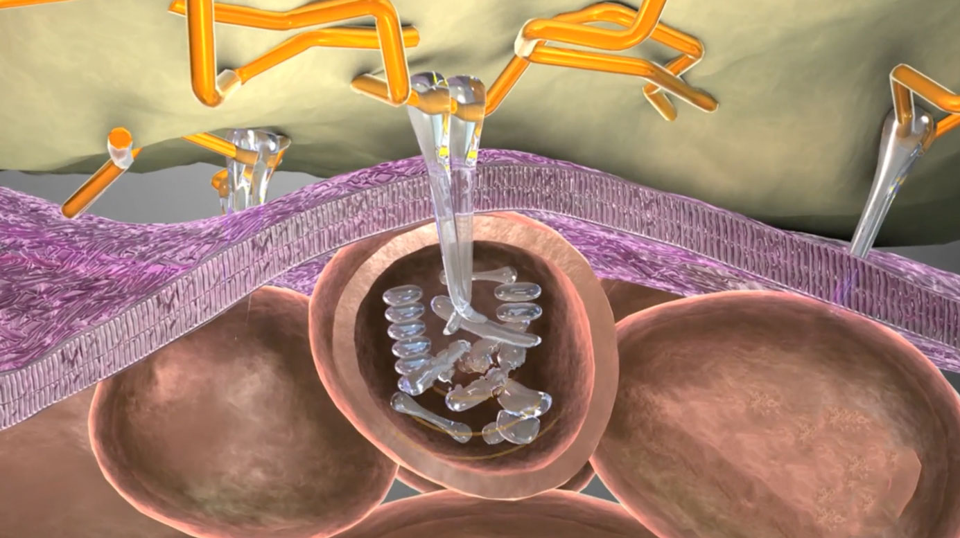 Dermatology Visualization & Animation | Ghost Medical