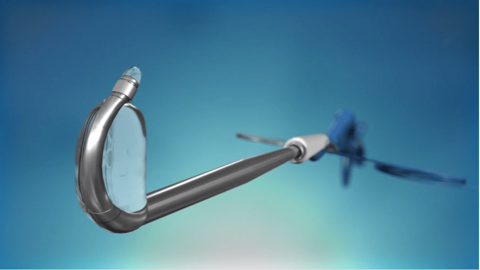 "Sinuplasty Animation Case Study: Medtronic NuVent"
