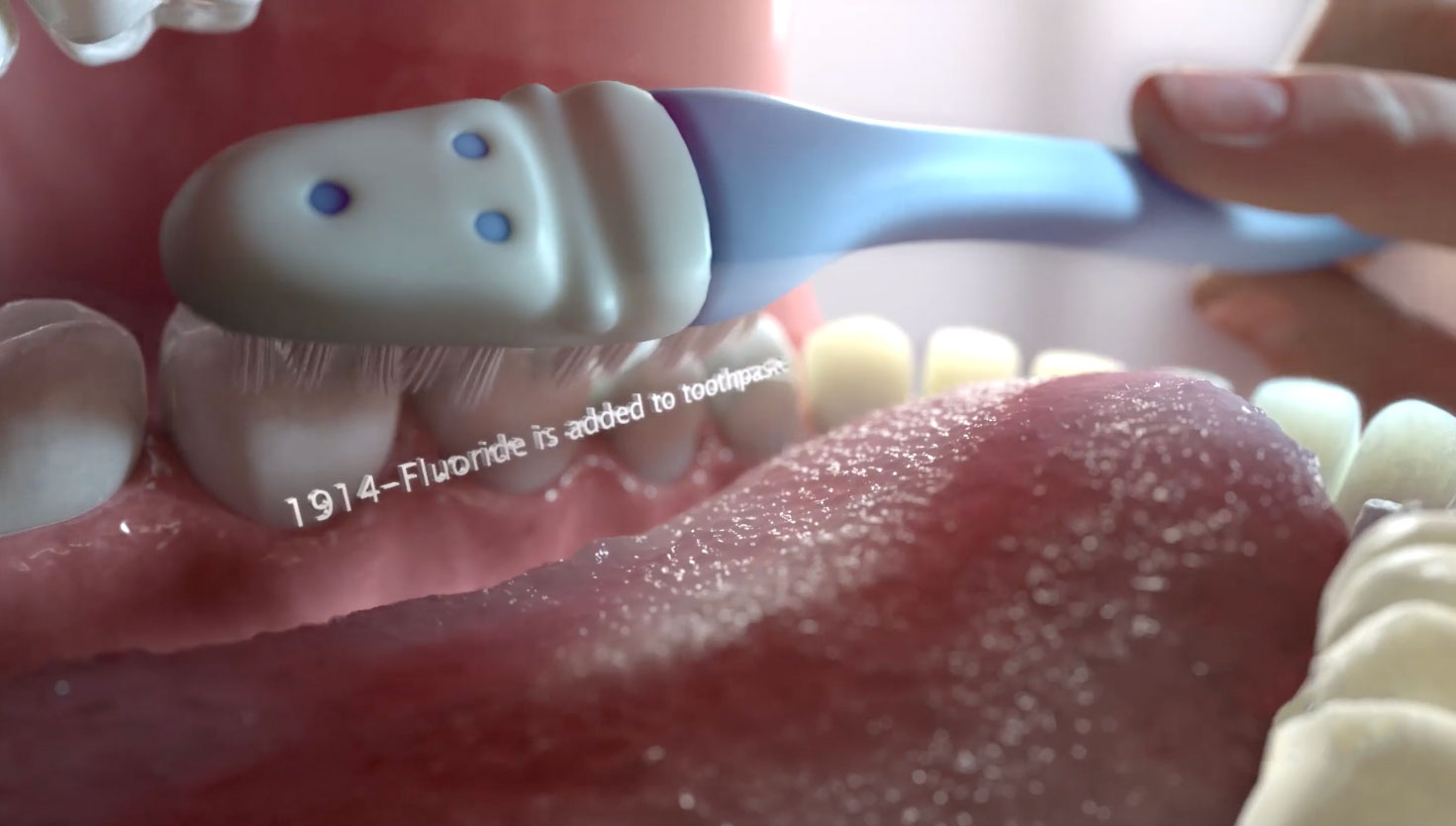 Dental Animation | Ghost Medical