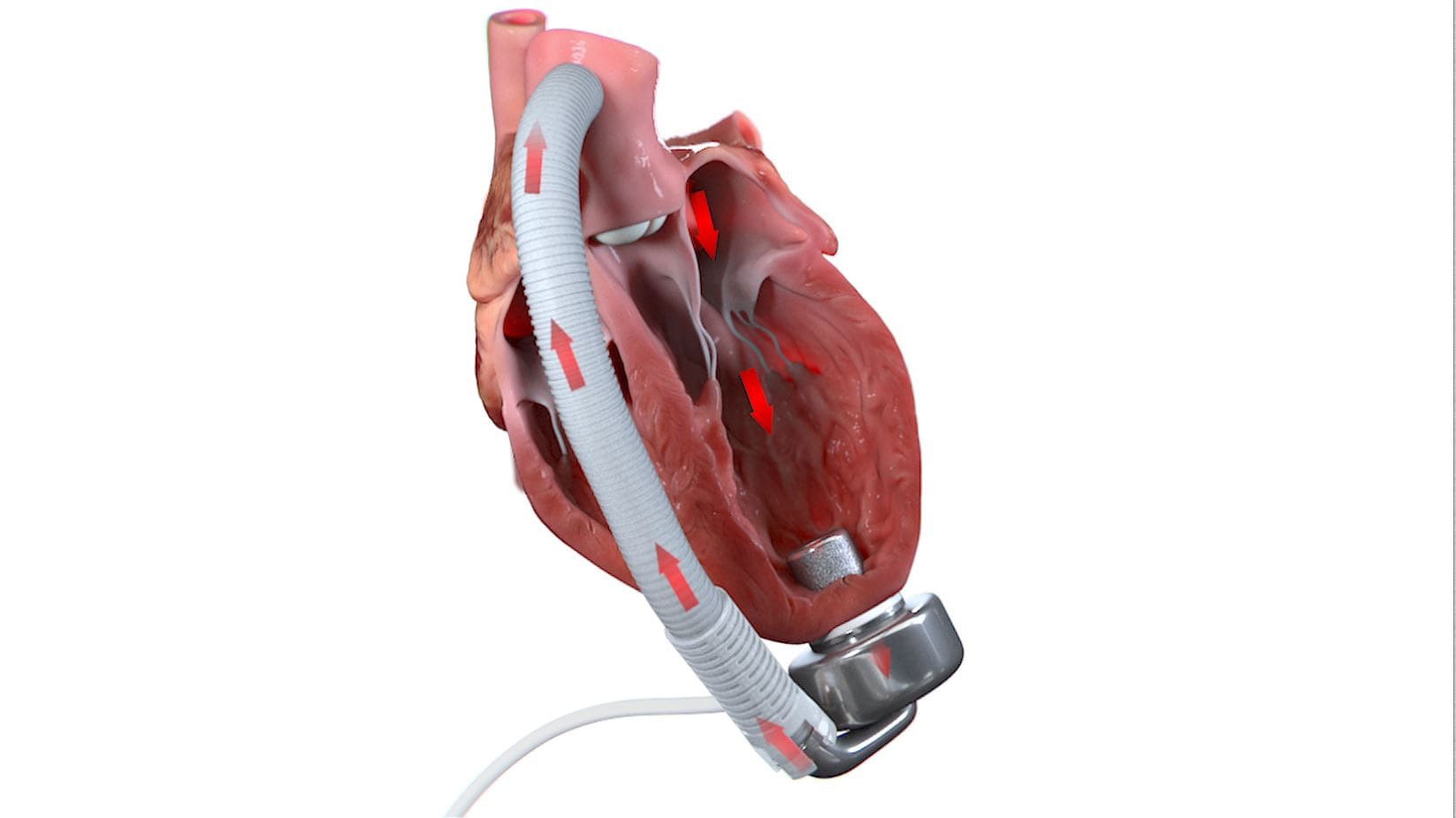 "Uses of Virtual Reality in Cardiology"