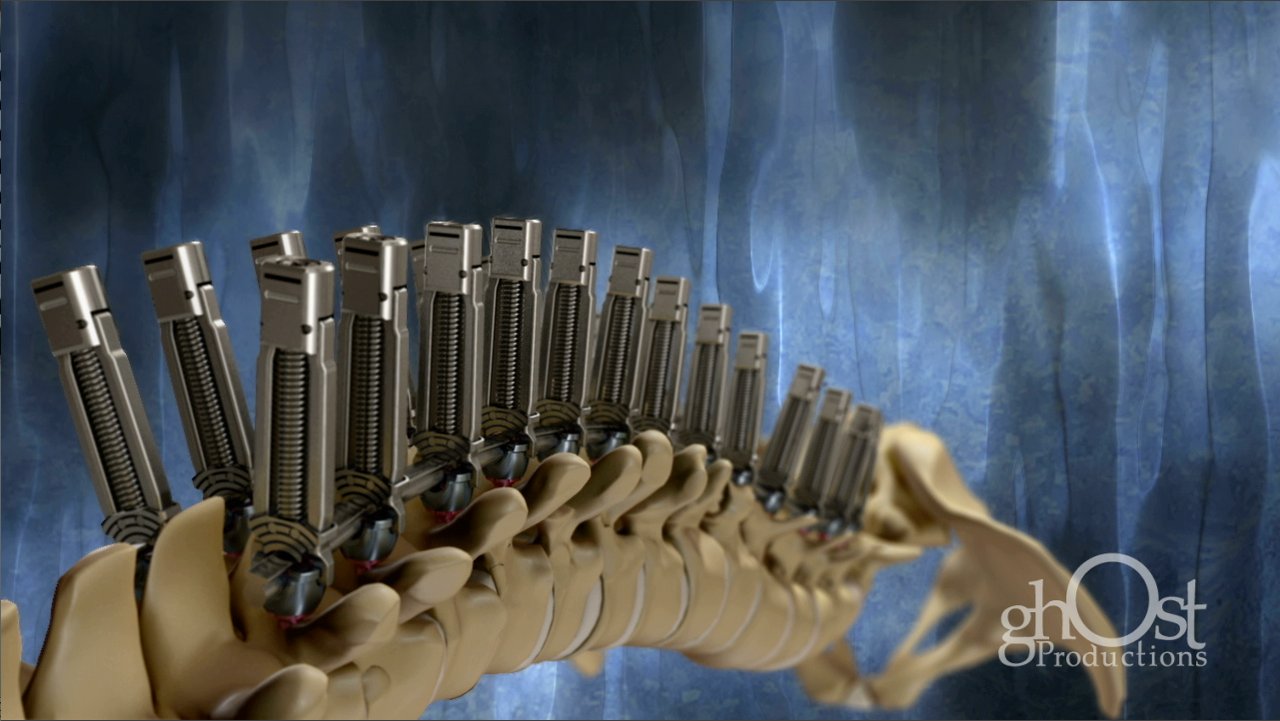 "Medical Animation Case Study: K2M Climbers 3 (2013)"