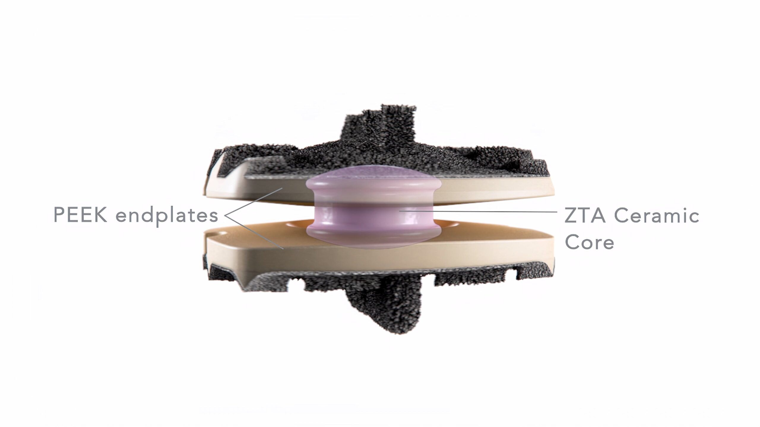 Ghost Productions - NuVasive - Simplify Disc | Video