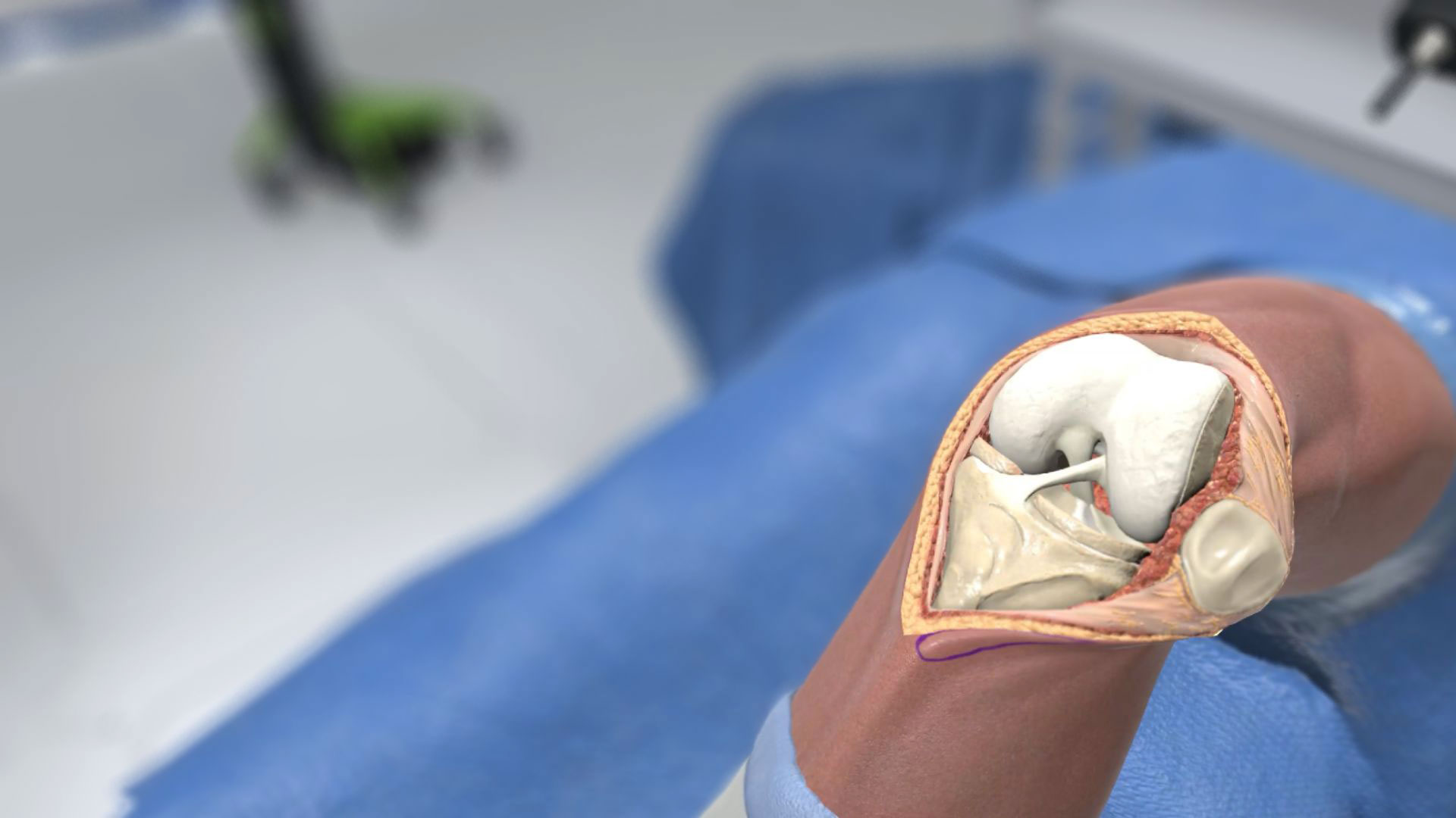"Is The Oculus Quest Powerful Enough to Deliver Surgical Simulations?"