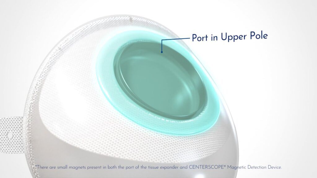 "Breast Cancer Reconstruction Options You May Not Know"