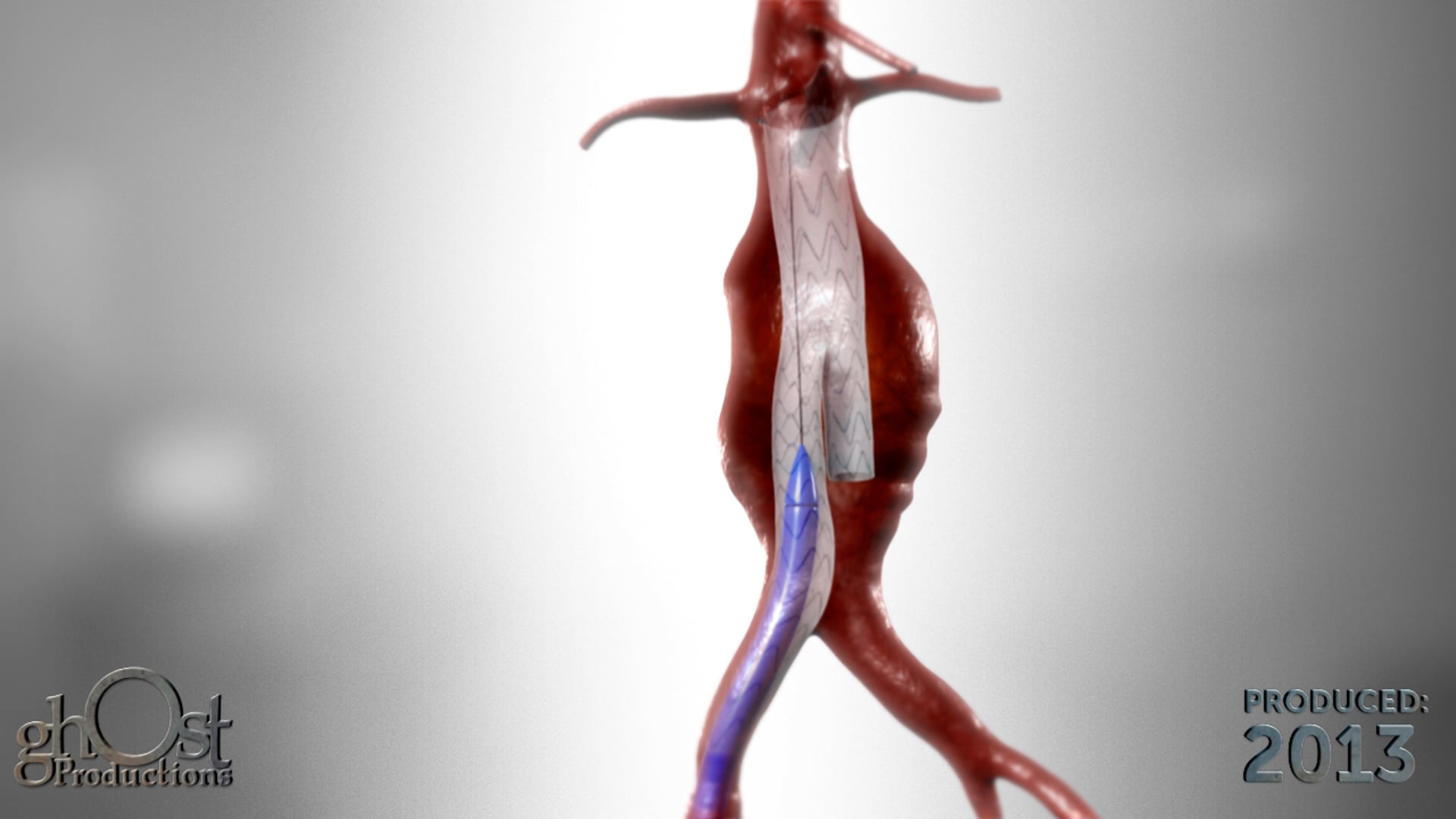 Magnetech | Ghost Medical Client