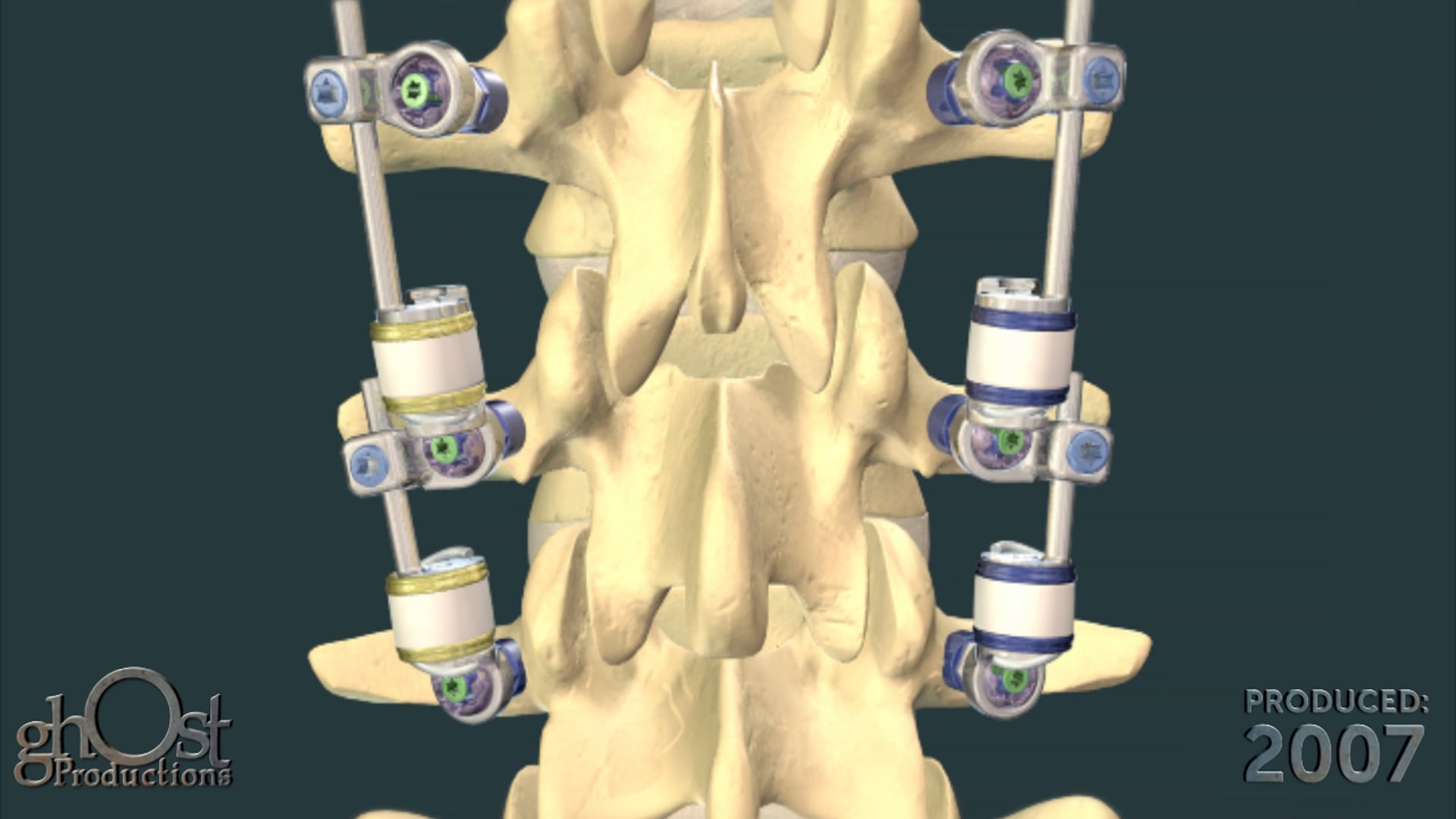 Applied Spine | Ghost Medical Client