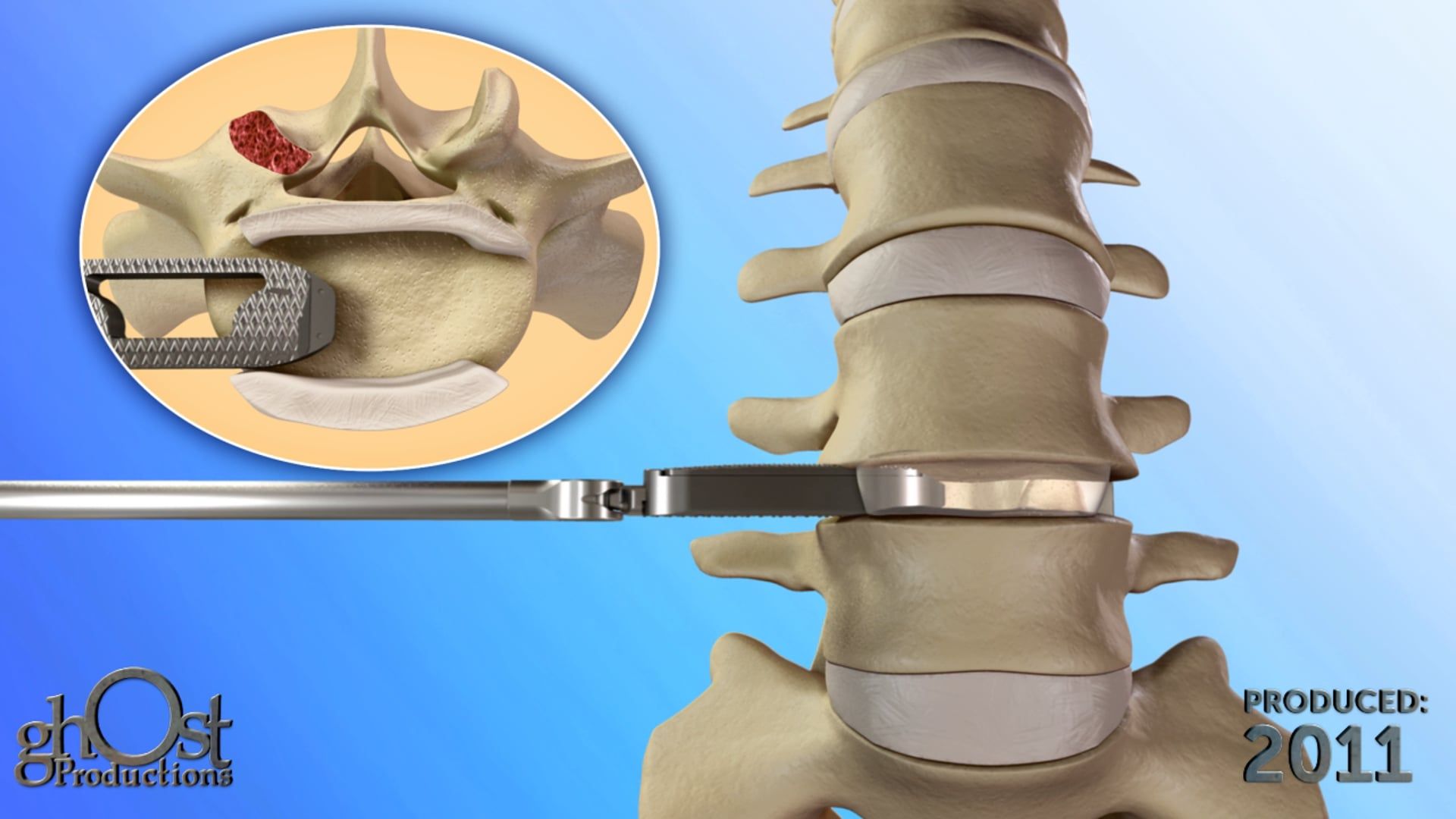 Stryker | Ghost Medical Client
