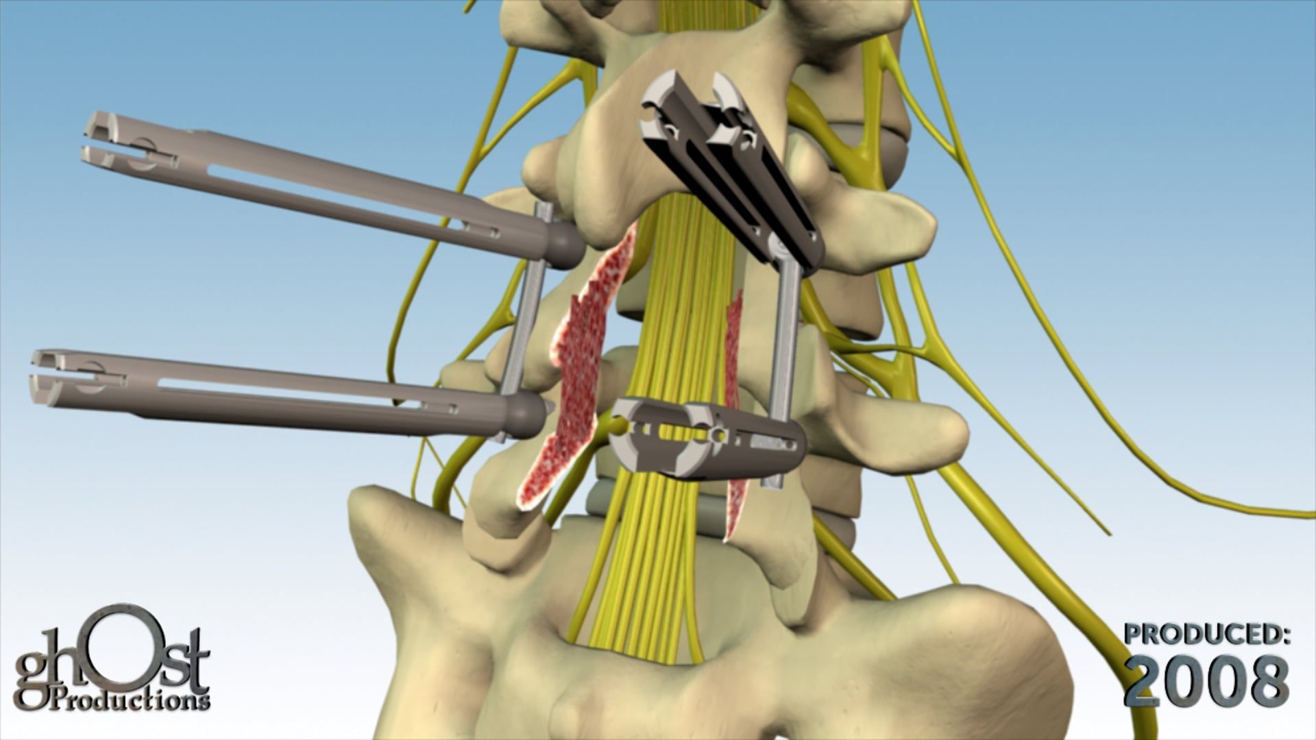 Abbott | Ghost Medical Client