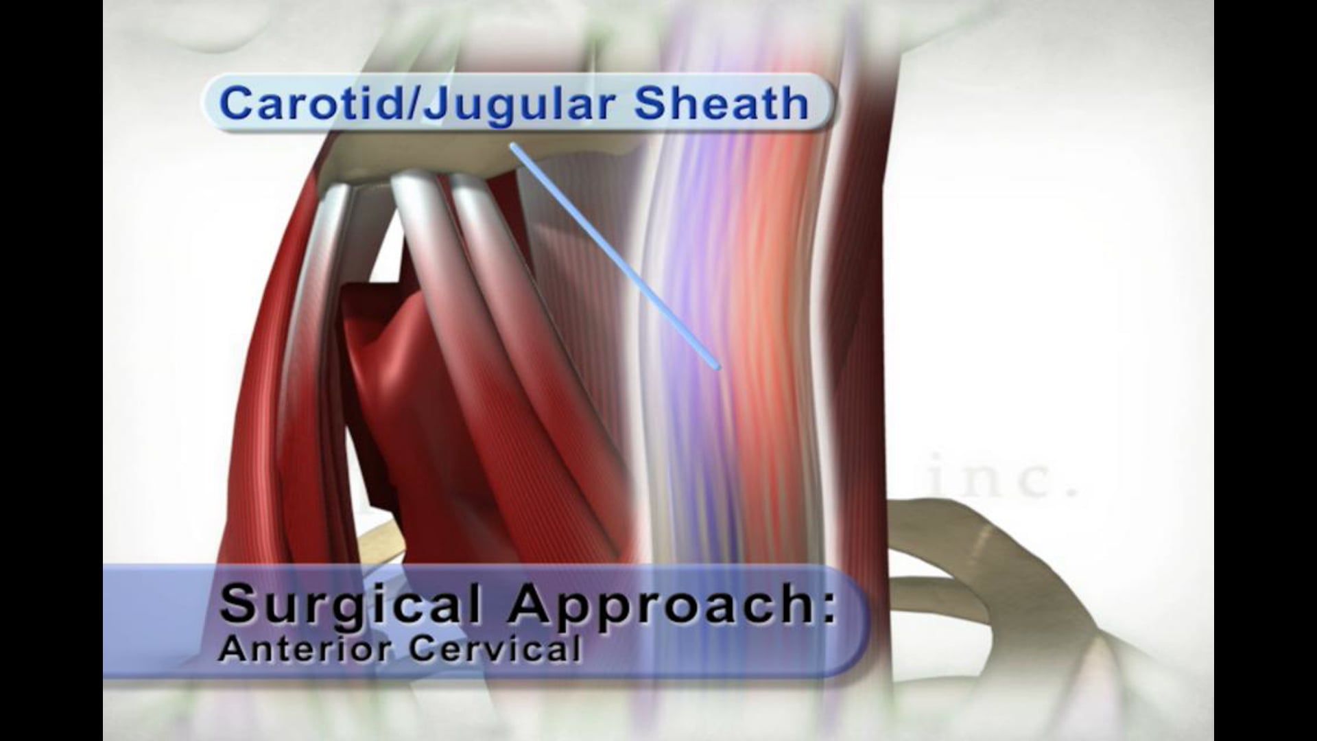 Ghost Productions - Surgical Approach - Anterior Cervical | Video