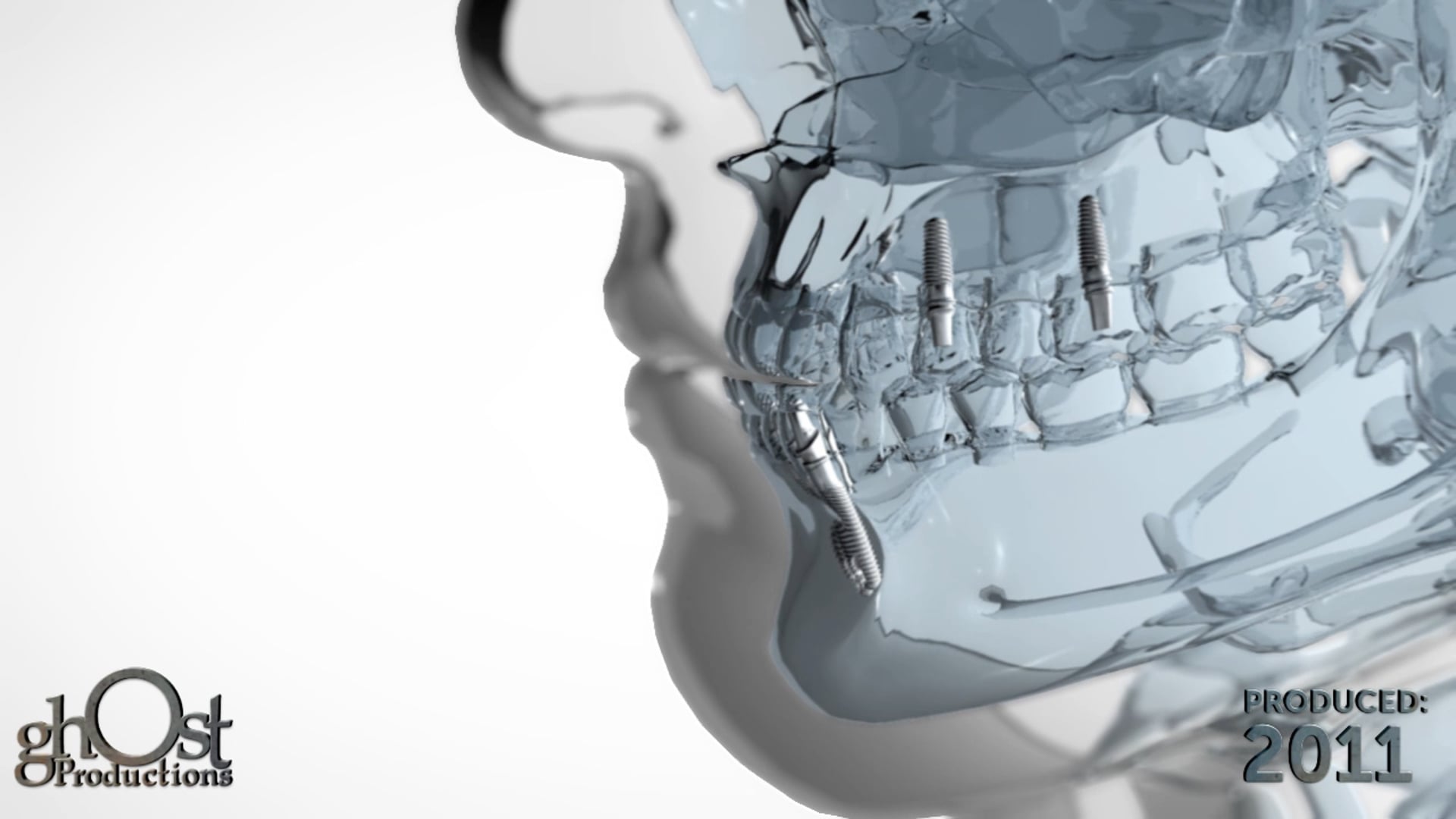 Dental Animation | Ghost Medical